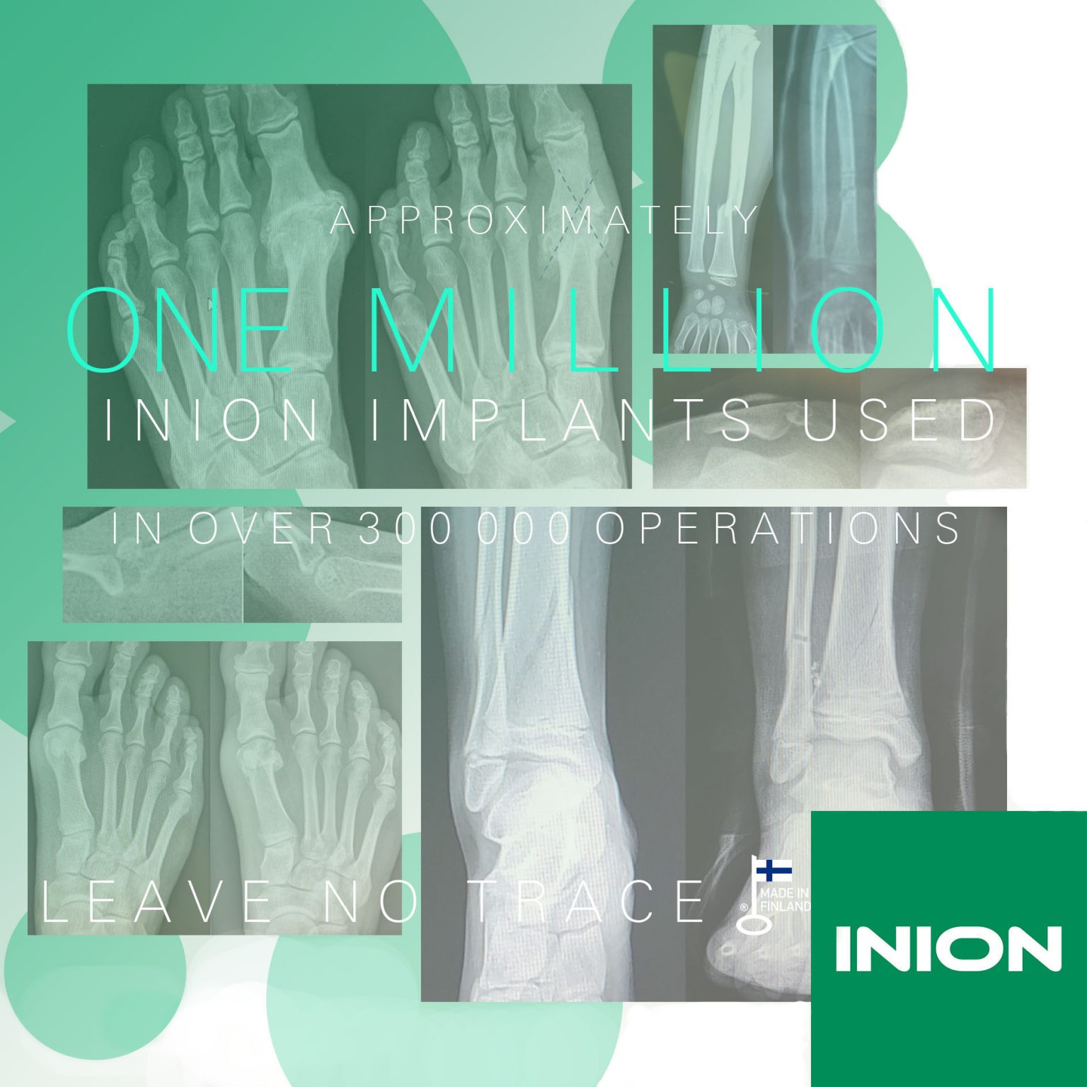 About Inion - Inion Oy